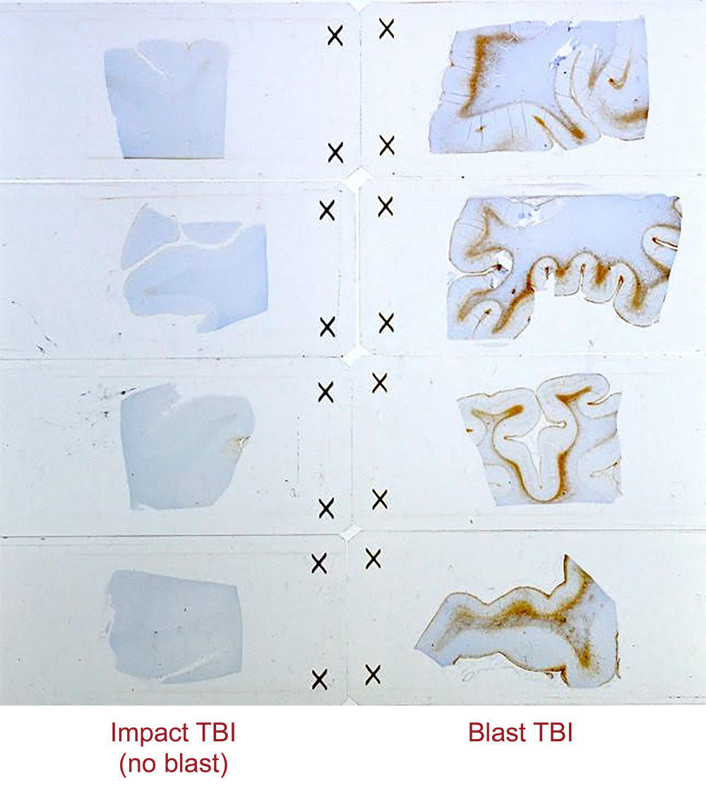 Our Research - Brain Tissue Repository